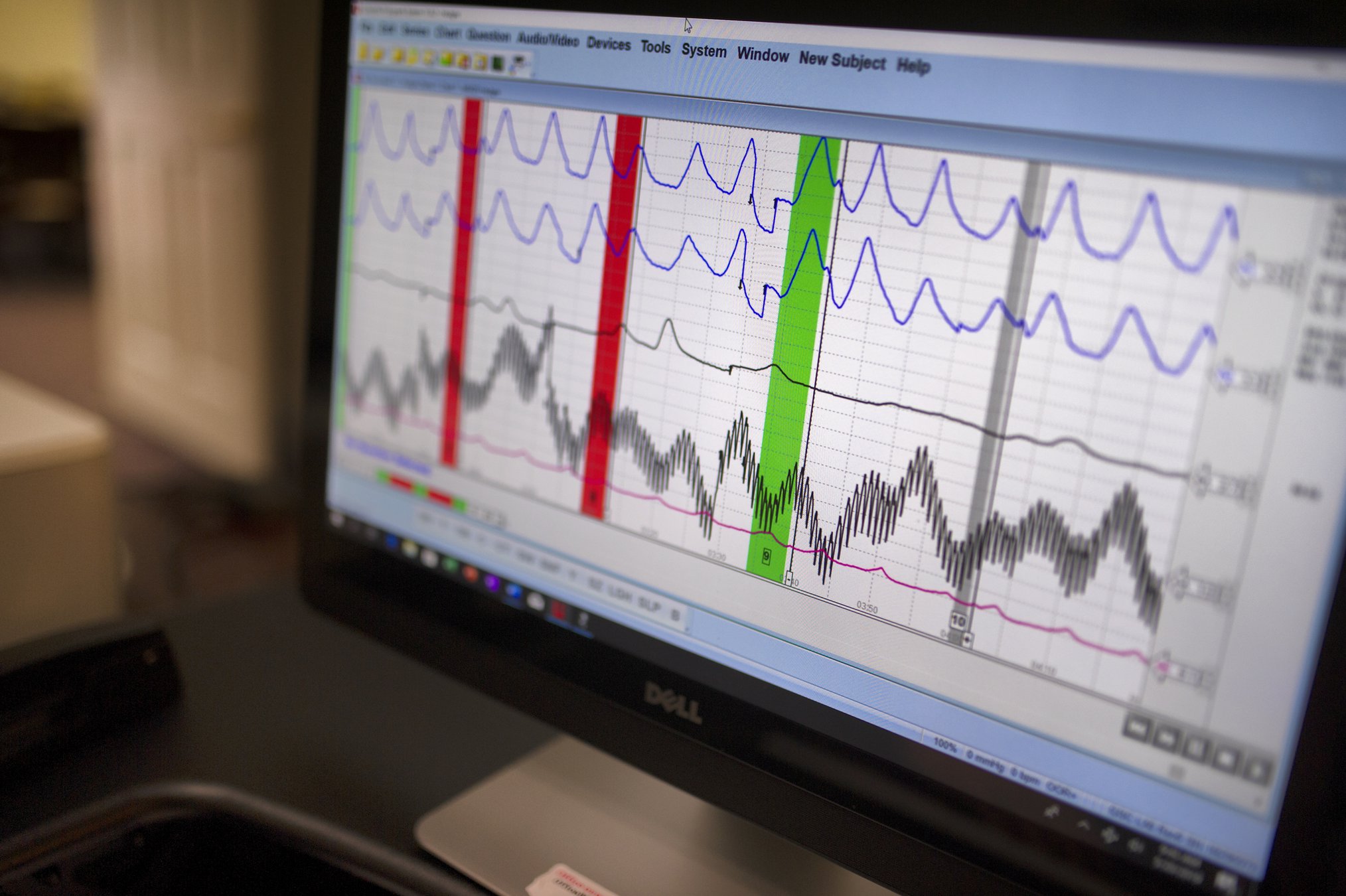 Former federal polygraph examiners clear up misconceptions in detecting ...